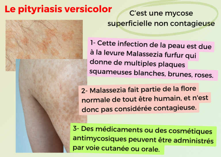 Faisons le point sur les 2 types principaux de pityriasis – Des livres ...